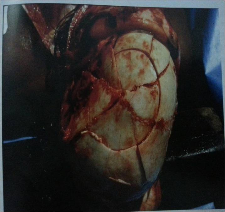 head and neck injuries copy1 at emaze Presentation