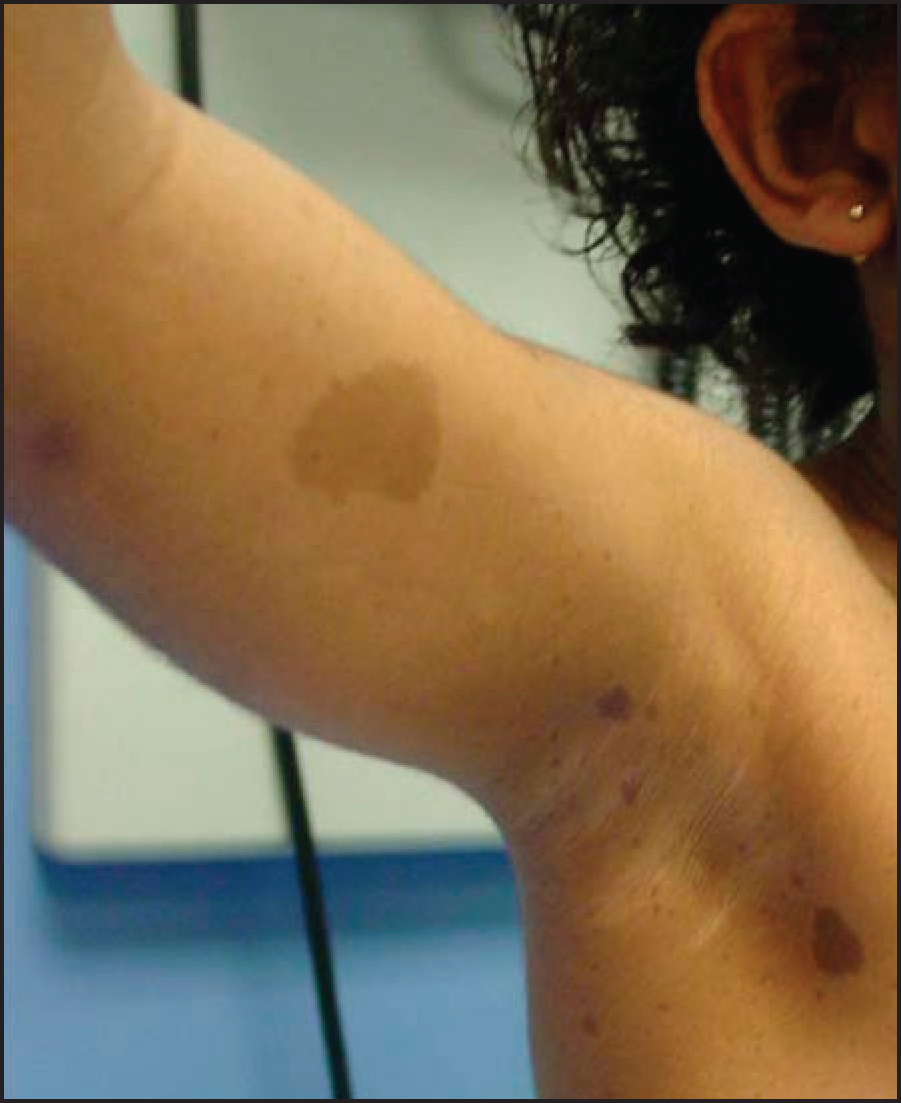 RASopathies on emaze