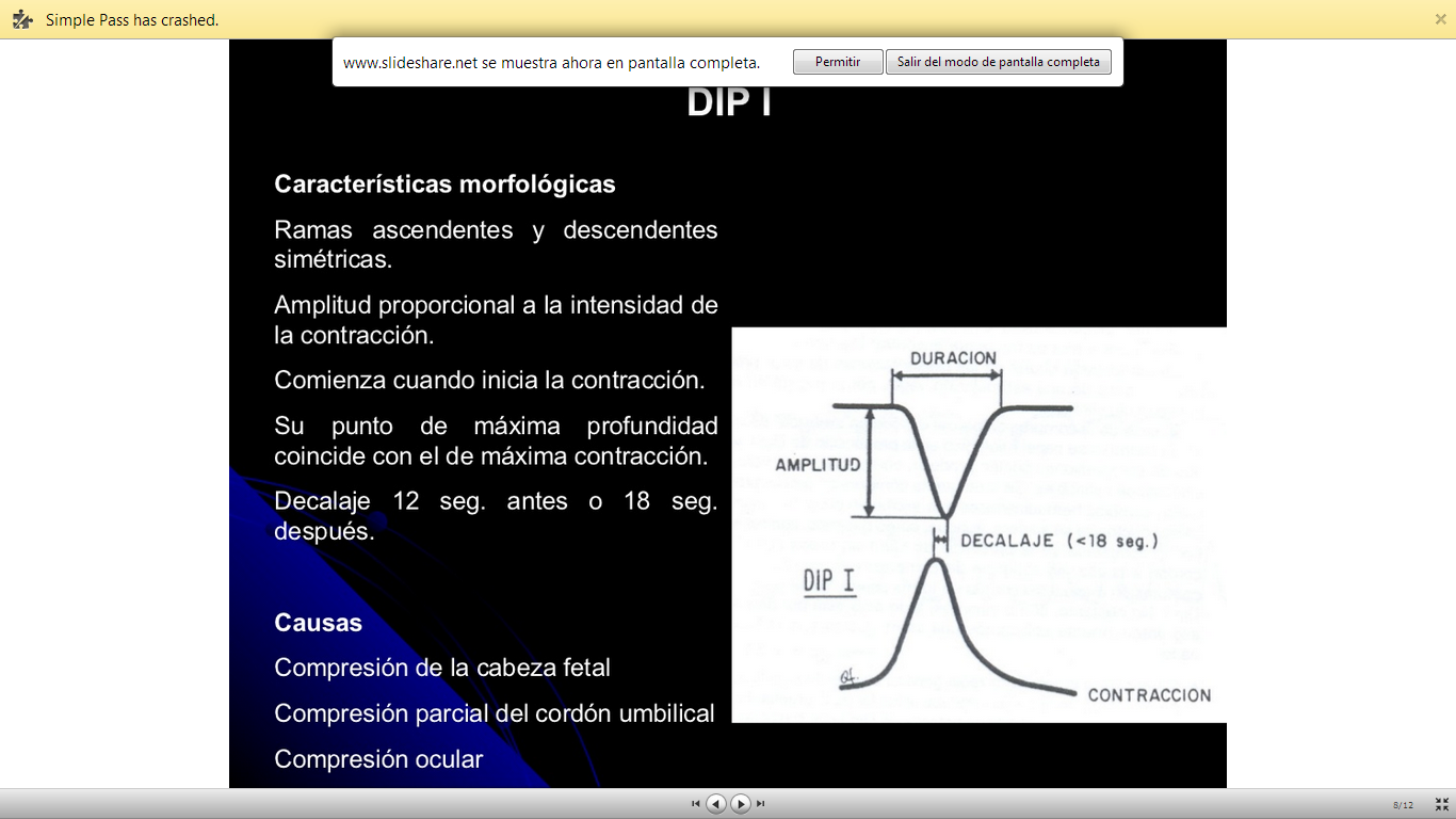 TDPyPelvimetría.pptx on emaze