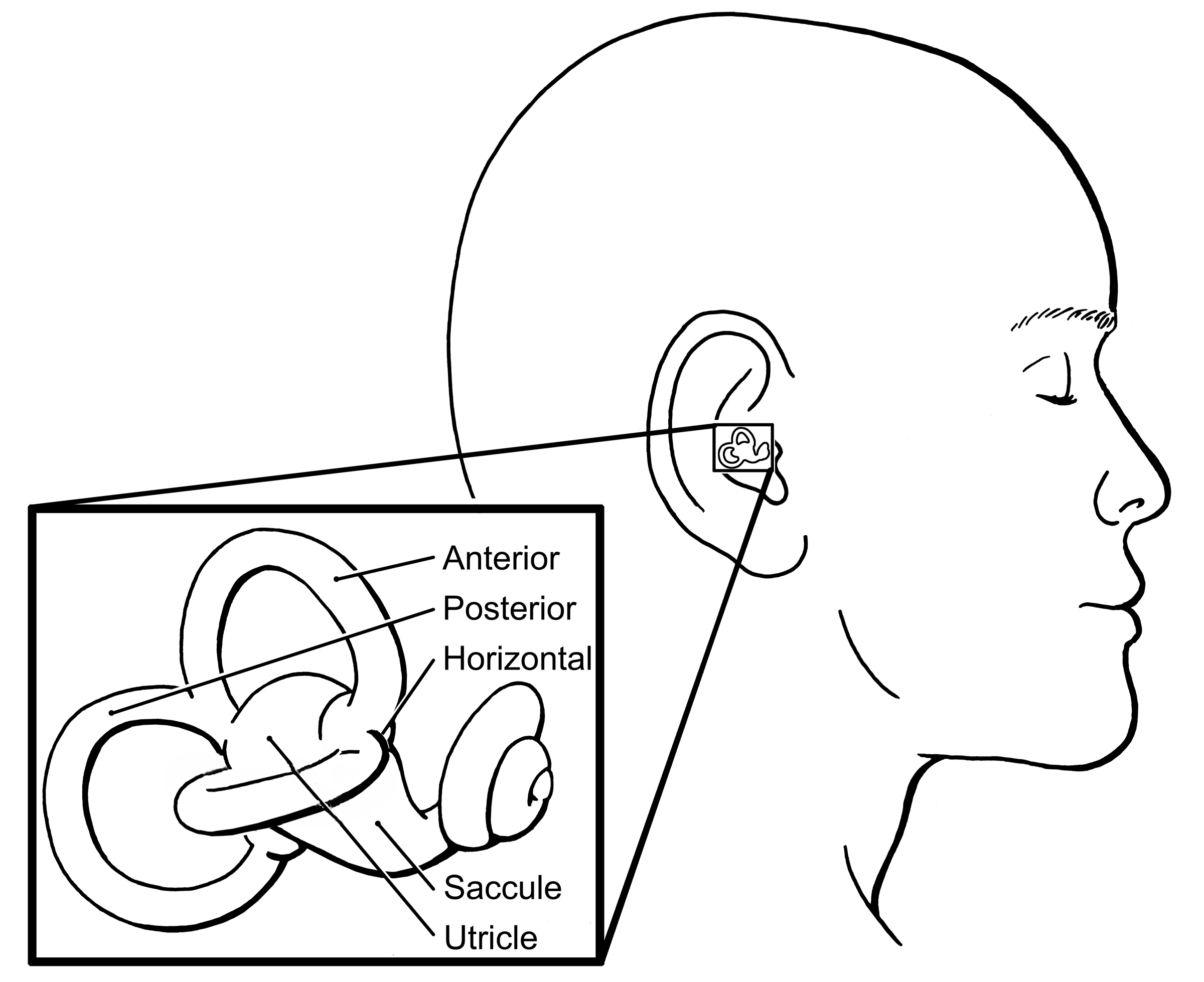 Bppv Canalith Repositioning Maneuver Hand Out