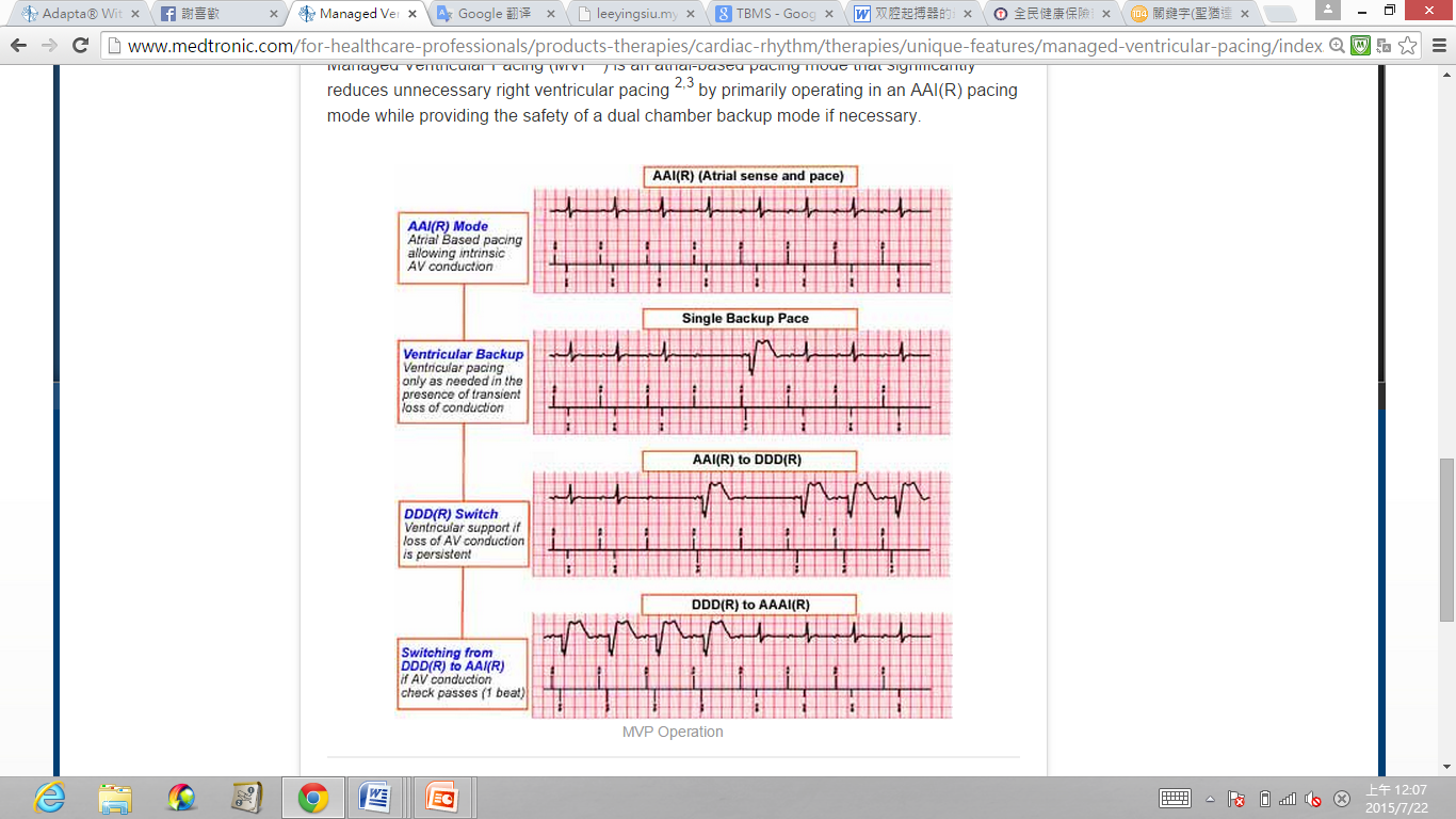 Adapta pacemaker.pptx at emaze Presentation
