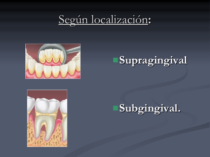 microbiologia periodontal on emaze