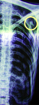 Otzi The Ice Man and Narrabeen man at emaze Presentation