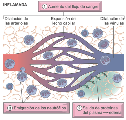Inflamación aguda.pptx at emaze Presentation