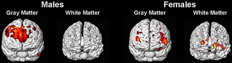 The Difference between the Male/Female Brain on emaze