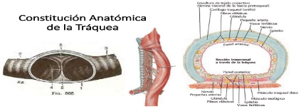TRAQUEALa tráquea es on emaze