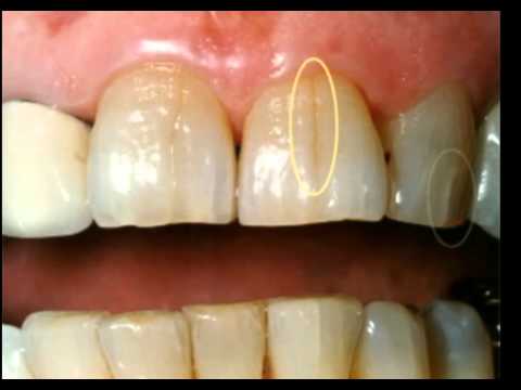 The Perfect Lesson on emaze