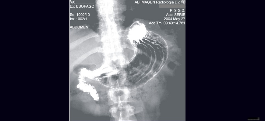 Conceptos de Radiologia on emaze
