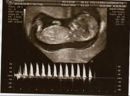 comment connaître si un foetus est mâle ou femelle, bien on emaze