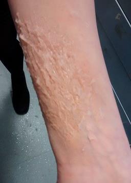 Makeup Burn at emaze Presentation