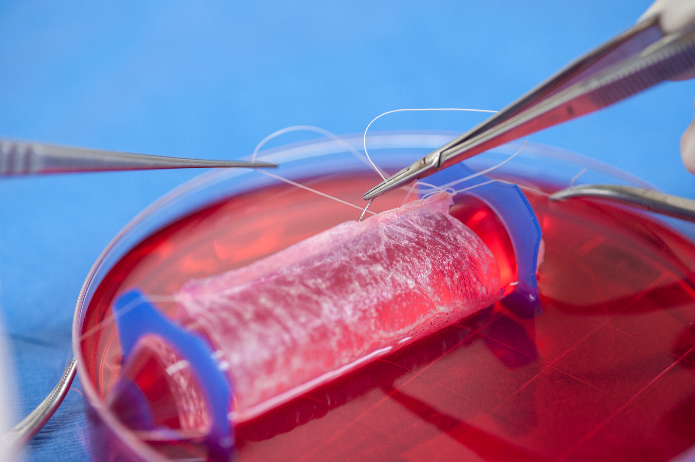 Regenerative Medicine on emaze