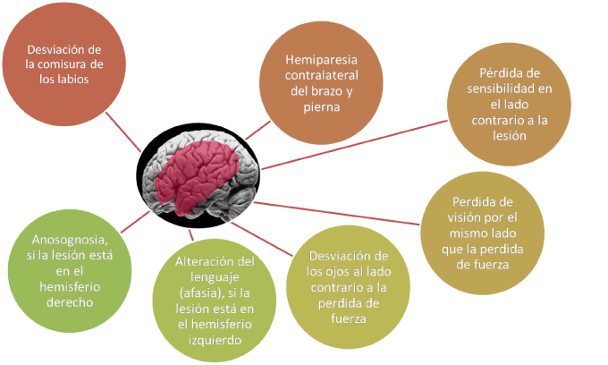 Accidentes Cerebrovasculares Pptx At Emaze Presentation