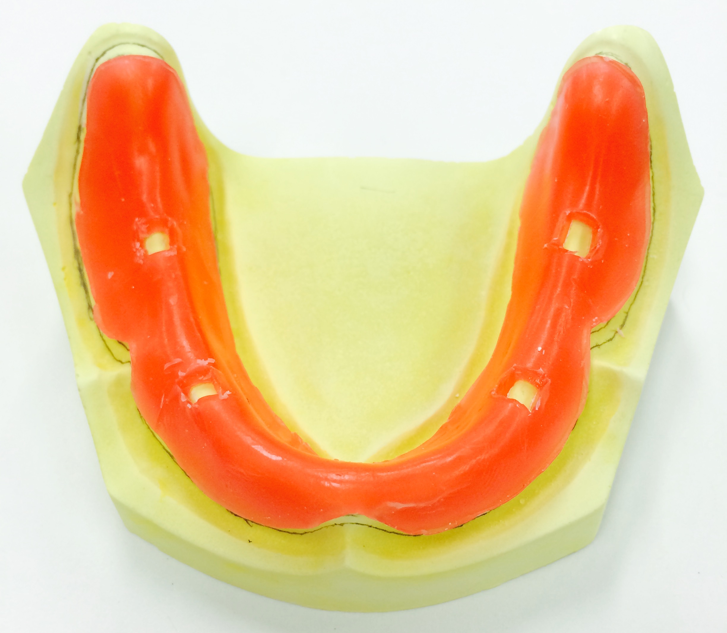 총의치 개인트레이 on emaze