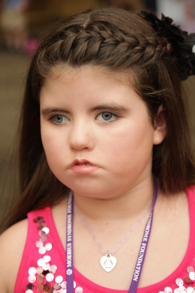 Moebius Syndrome at emaze Presentation