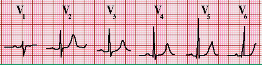 ECG on emaze