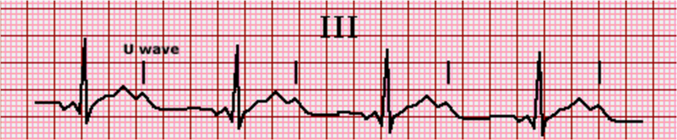 ECG on emaze