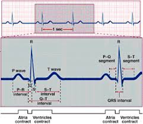 ECG at emaze Presentation