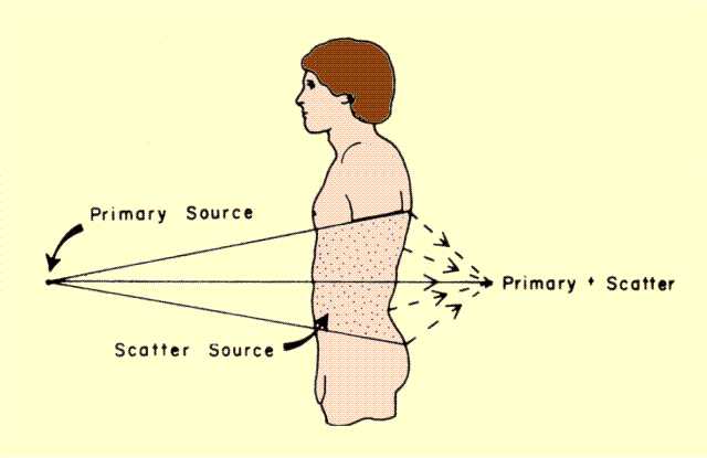 ScatterRadiation on emaze