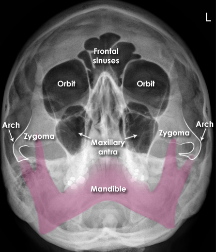 Facial Bones Xray tutorial on emaze