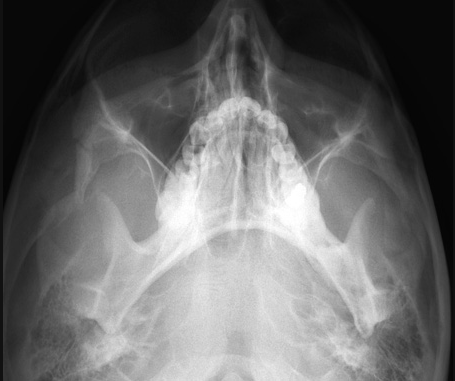 Facial Bones Xray tutorial on emaze