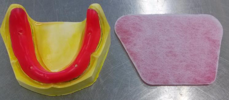 총의치 개인트레이 전 제작과정 on emaze