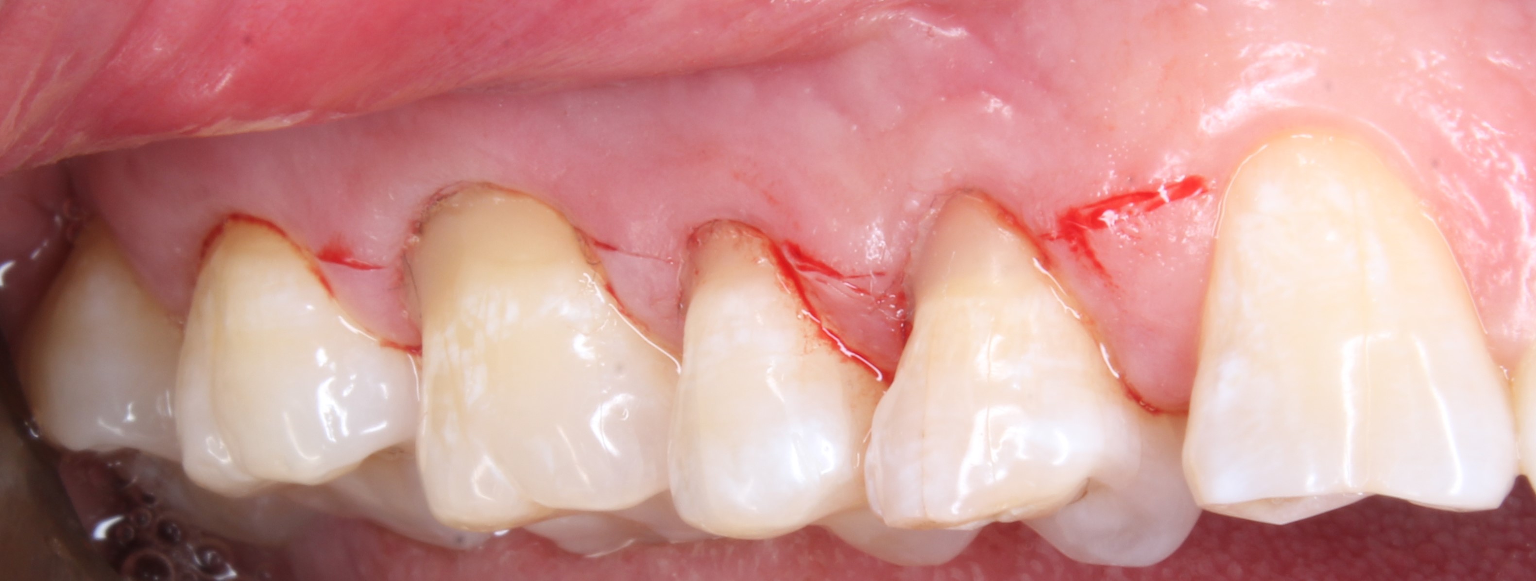 Caso clínico 1 CAF on emaze