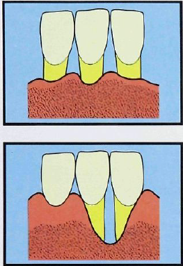 Caso clínico 1 CAF on emaze