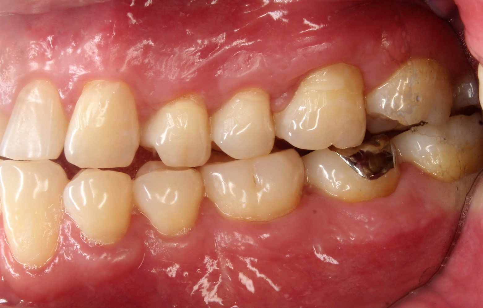 Caso clínico 1 CAF on emaze