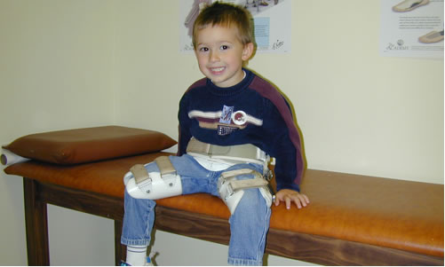 Legg-Calve-perthes disease at emaze Presentation