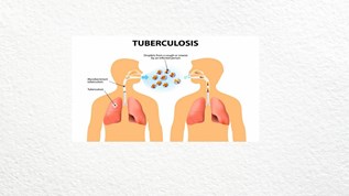 Tuberculosis at emaze Presentation