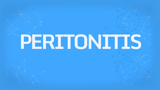 PERITONITIS at emaze Presentation