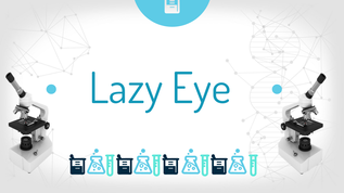 Science - Lazy eye at emaze Presentation