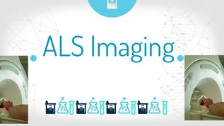 Medical Imaging for ALS at emaze Presentation