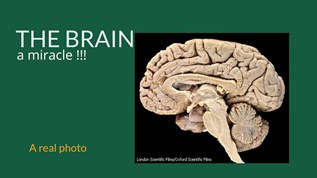 The brain at emaze Presentation