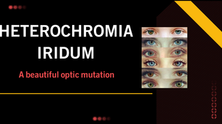 Heterochromia Iridum at emaze Presentation