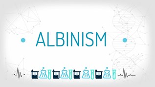 ALBINISM at emaze Presentation