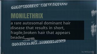 MONILETHRIX at emaze Presentation