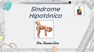 sindrome hipotonico at emaze Presentation
