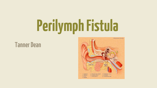 Perilymph Fistula at emaze Presentation