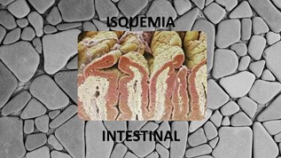 isquemia-intestinal.pptx at emaze Presentation