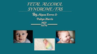 Fetal Syndrome at emaze Presentation