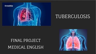 TUBERCULOSIS at emaze Presentation