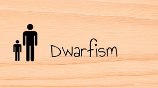 Dwafism at emaze Presentation