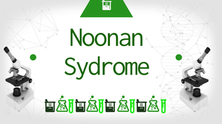 noonan sydrome at emaze Presentation
