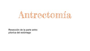 Antrectomía at emaze Presentation