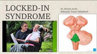 LOCKED-IN SYNDROME at emaze Presentation