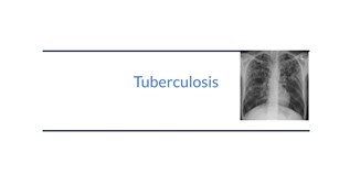 Tuberculosis at emaze Presentation