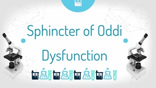 Sphincter of Oddi Dysfunction at emaze Presentation