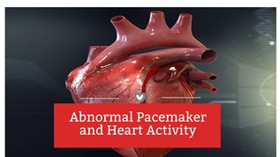 Pacemaker at emaze Presentation