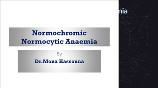 normocytic normochromic anemia.pptx at emaze Presentation